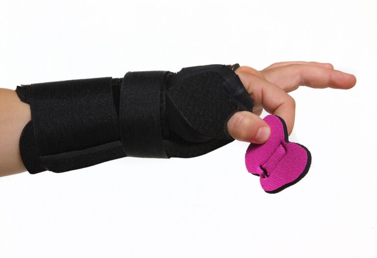 Extensora de Punho e abdutora de Polegar Dorsal e Ventral – Autonomie